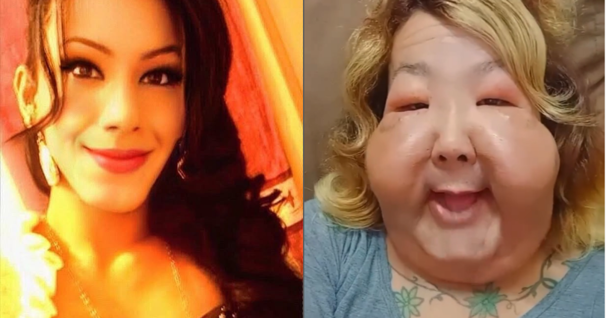 Influencer Juju do Pix inicia reconstrucción facial tras cirugía ...